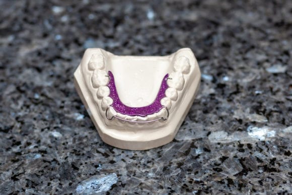 Retainers - Hough Orthodontics