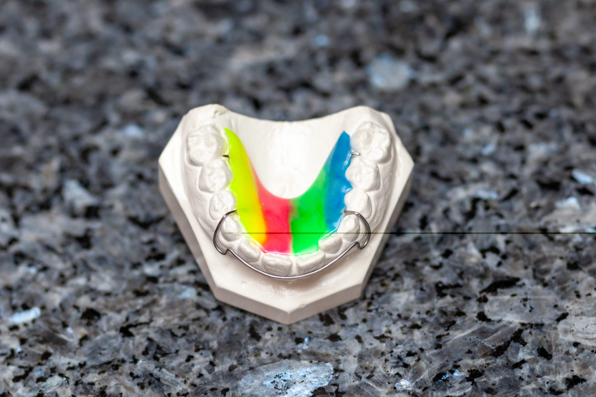 Retainers - Hough Orthodontics